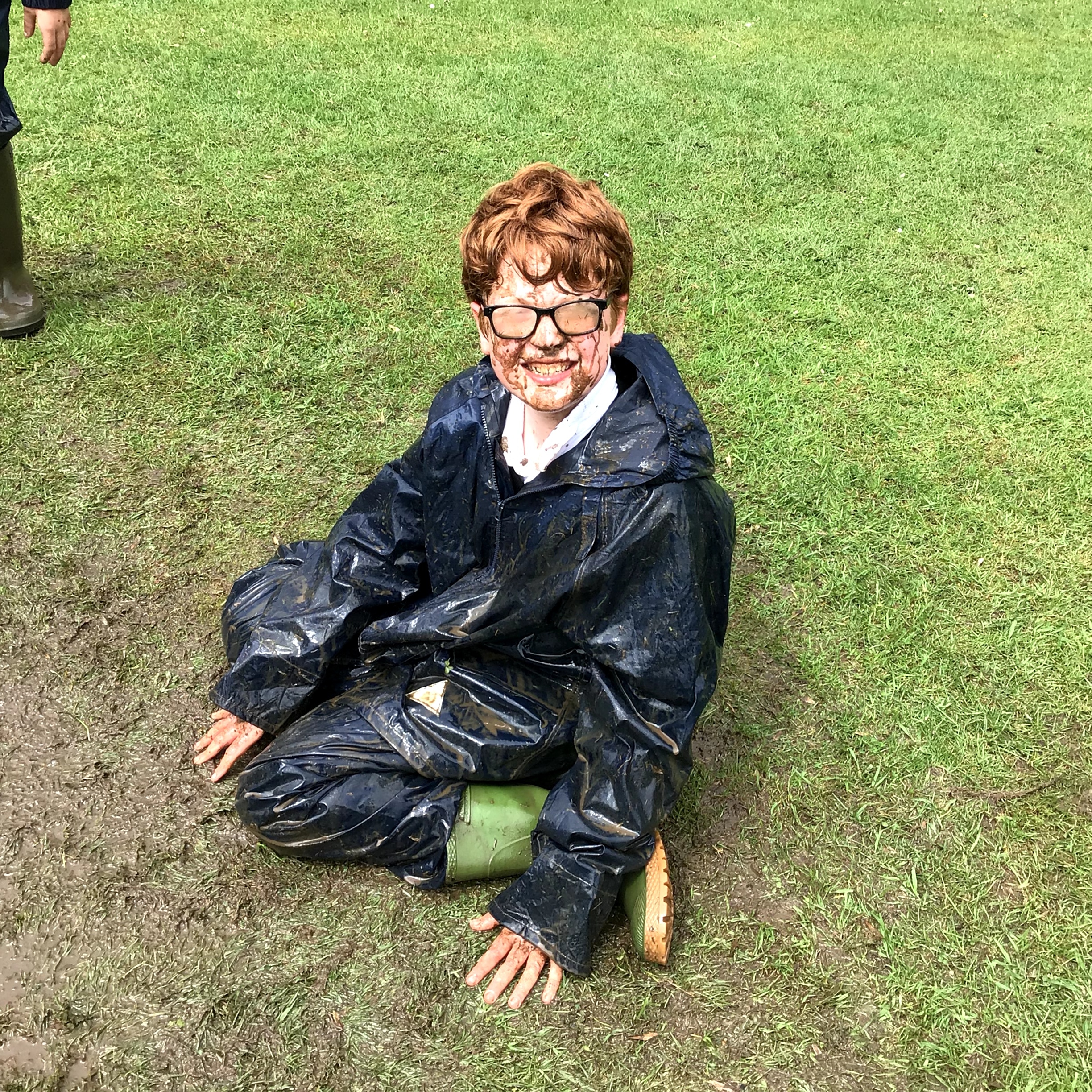 Rare disease as a jigsaw - Timothy Syndrome