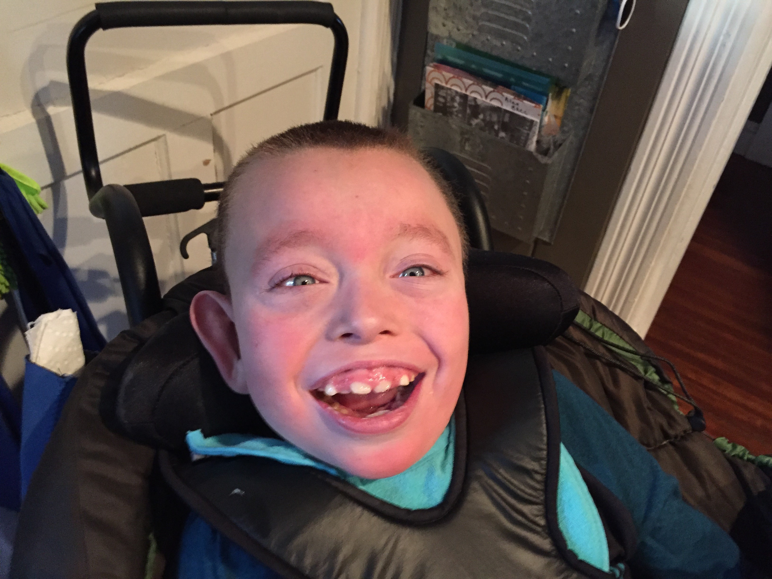 How we learnt about Menkes Syndrome