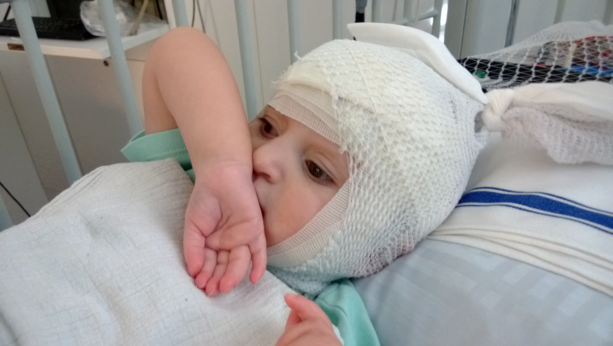 How Schinzel-Giedion Syndrome (SGS) has changed our lives